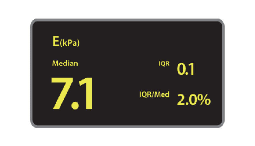 Mindray Ultrasound System Hepatus 5 - Series