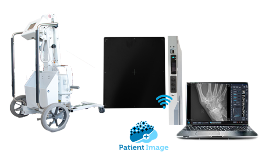 Mobile 1: Digital X-ray System (6Y Subscription)